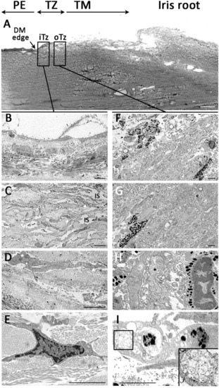 Cells | Free Full-Text | Characterization of Human Transition Zone ...