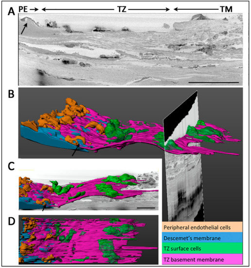 Characterization of Human Transition Zone Reveals a Putative Progenitor ...