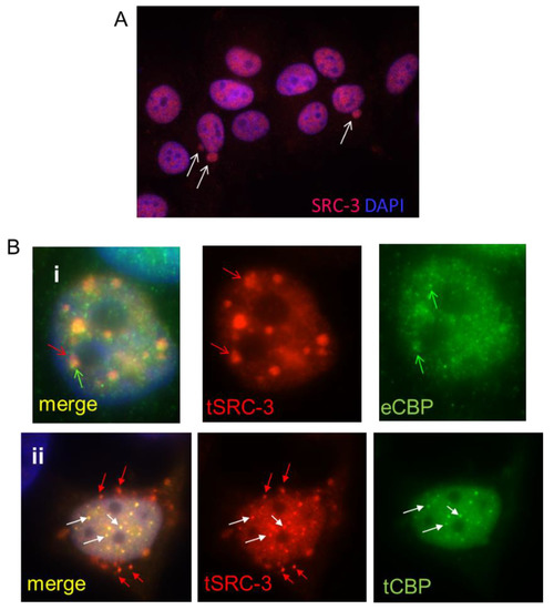 Intrinsically Disordered SRC-3/AIB1 Protein Undergoes Homeostatic ...