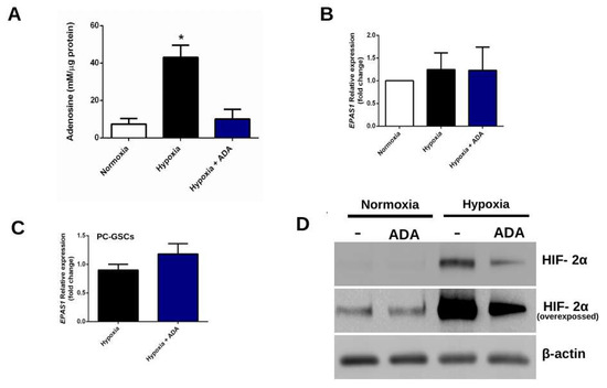 Adenosine Depletion as A New Strategy to Decrease Glioblastoma Stem-Like Cells Aggressiveness