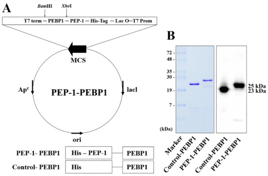 Phosphatidylethanolamine-Binding Protein 1 Ameliorates Ischemia-Induced ...