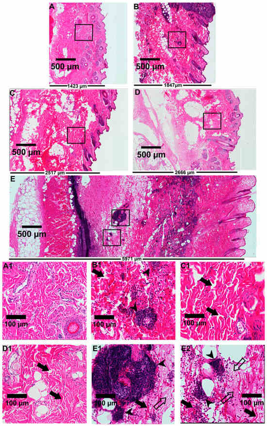 Cells | Free Full-Text | TCTP from Loxosceles Intermedia (Brown Spider ...