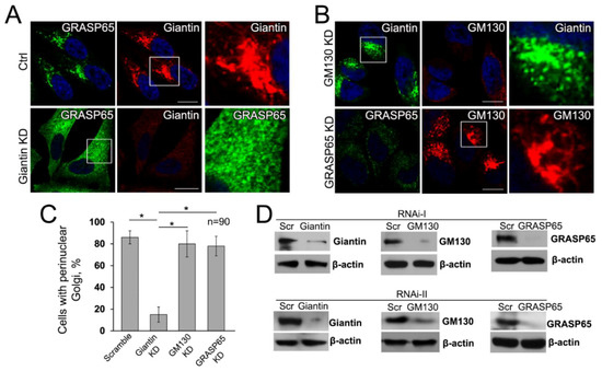 Cells | Free Full-Text | Post-ER Stress Biogenesis of Golgi Is Governed ...