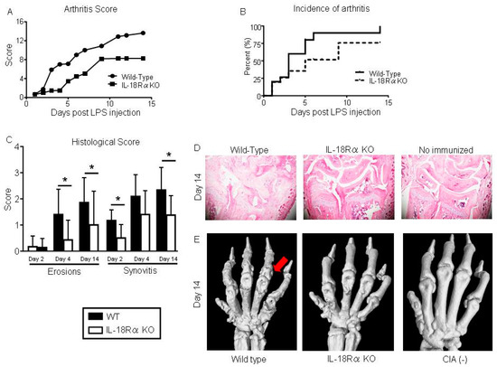 Cells | Free Full-Text | Inhibition of the IL-18 Receptor Signaling ...