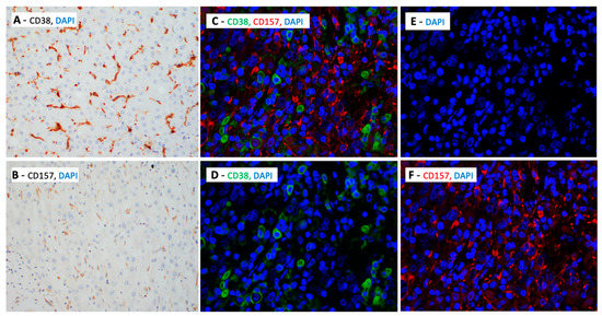 Cells | Special Issue : CD38 and Disease: A Bi-Directional Cross-Talk ...