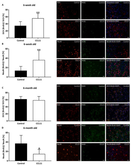 CCL11 Differentially Affects Post-Stroke Brain Injury and ...
