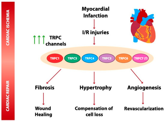 Cells | Free Full-Text | TRPC Channels: Dysregulation and Ca2+ Mishandling in Ischemic Heart Disease