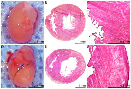 Natural Heart Regeneration in a Neonatal Rat Myocardial Infarction Model