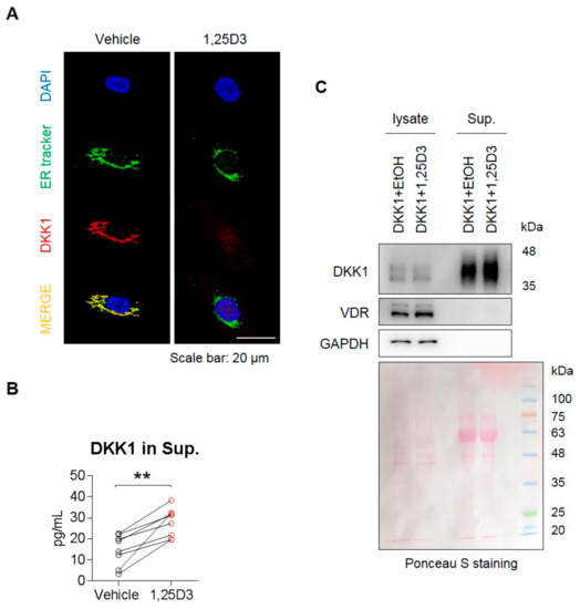 DKK1 Induced by 1,25D3 Is Required for the Mineralization of Osteoblasts