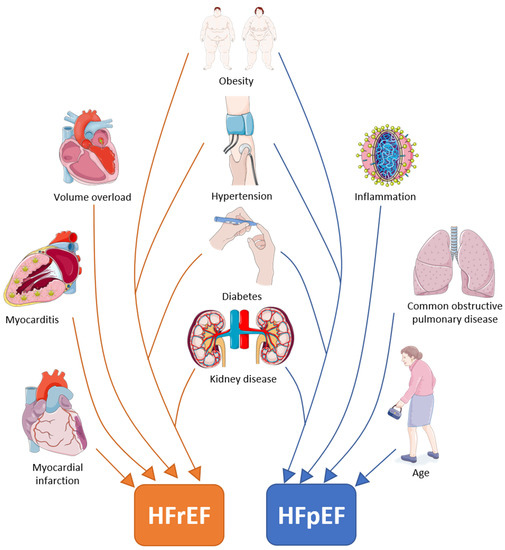 Cellular and Molecular Differences between HFpEF and HFrEF: A Step ...