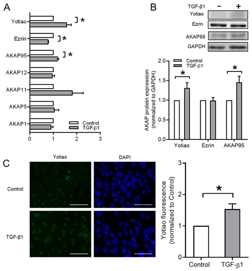 A-Kinase Anchoring Proteins Diminish TGF-β1/Cigarette Smoke-Induced ...