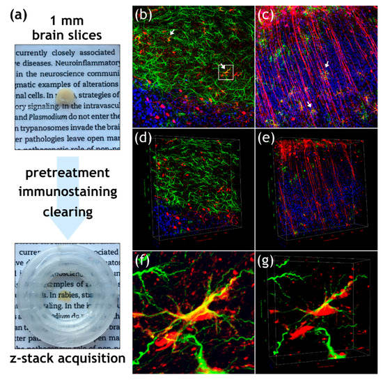 Astrocyte Infection during Rabies Encephalitis Depends on the Virus ...