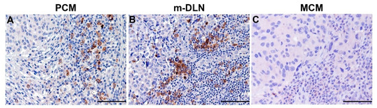 Human Plasmacytoid Dendritic Cells and Cutaneous Melanoma