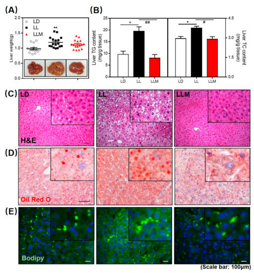 Melatonin Orchestrates Lipid Homeostasis through the Hepatointestinal ...