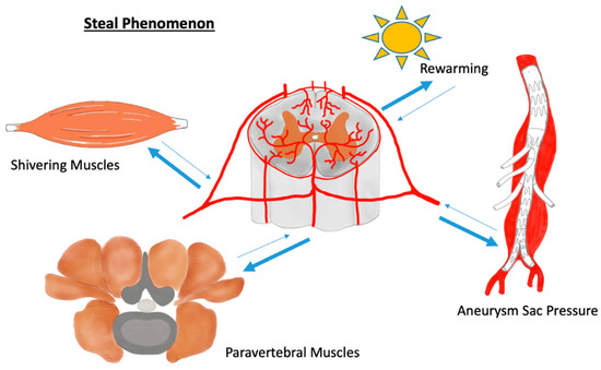 Arteriogenesis of the Spinal Cord—The Network Challenge