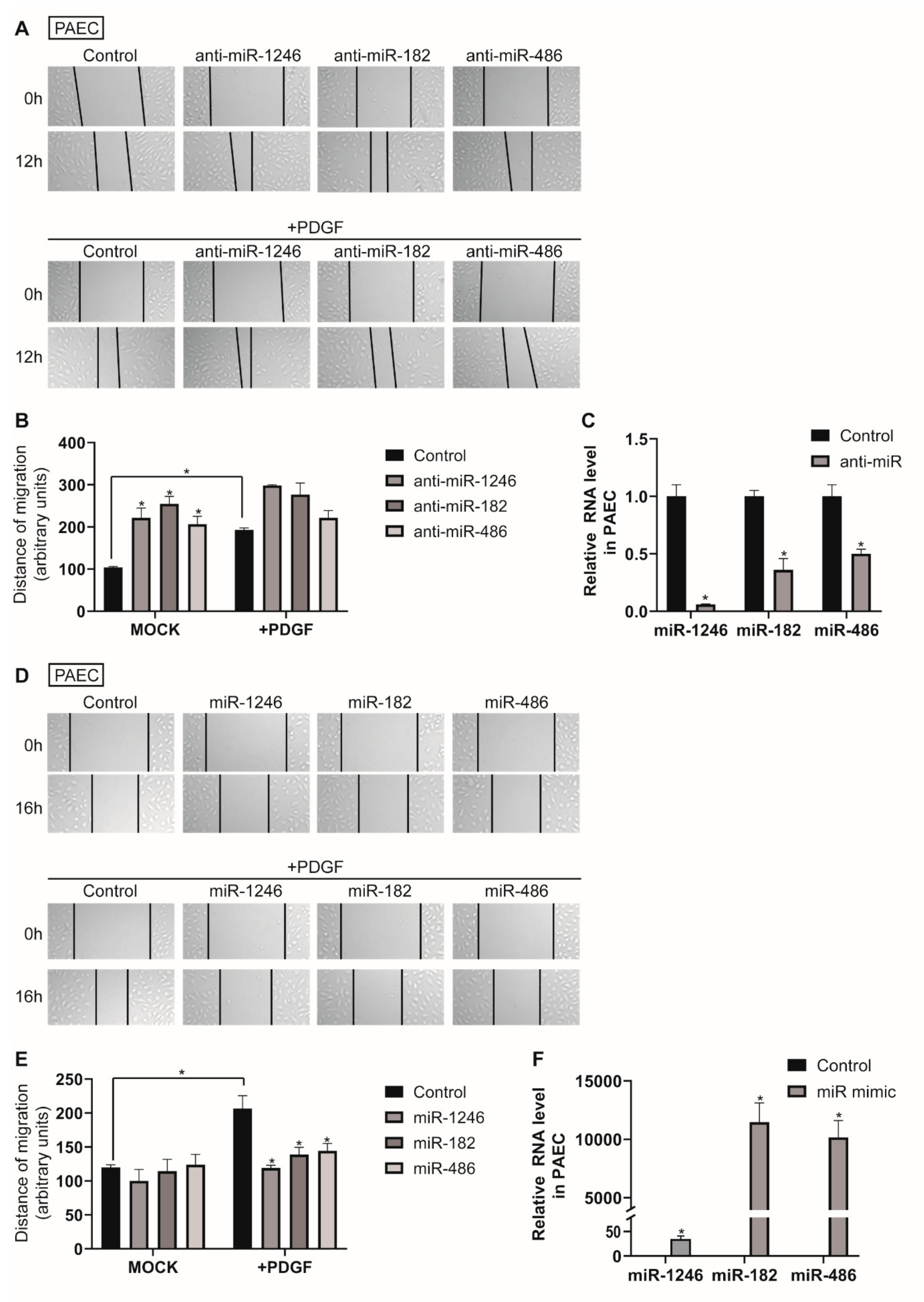 Vascular Smooth Muscle Cell-Derived Exosomal MicroRNAs Regulate Endothelial Cell Migration Under ...