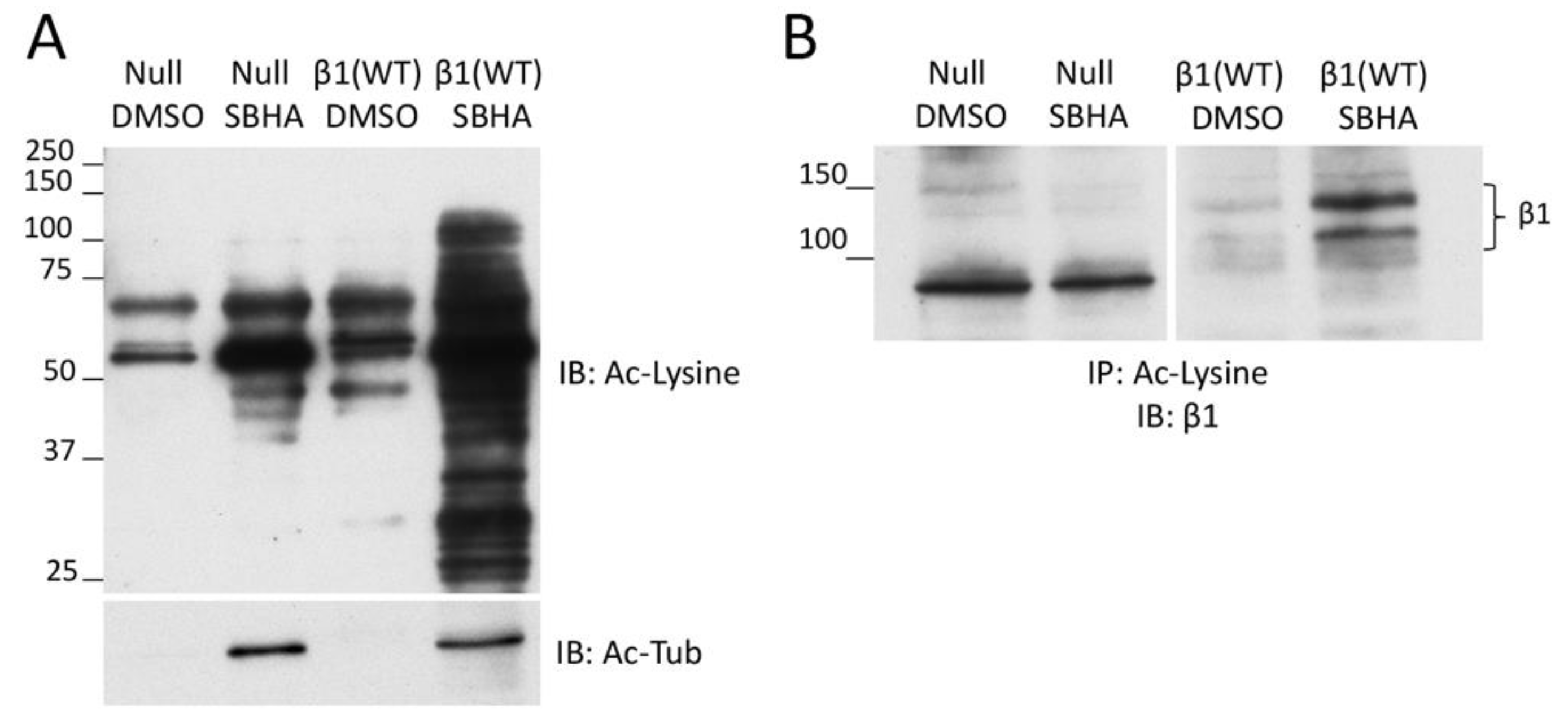Stimulation of Fibronectin Matrix Assembly by Lysine Acetylation
