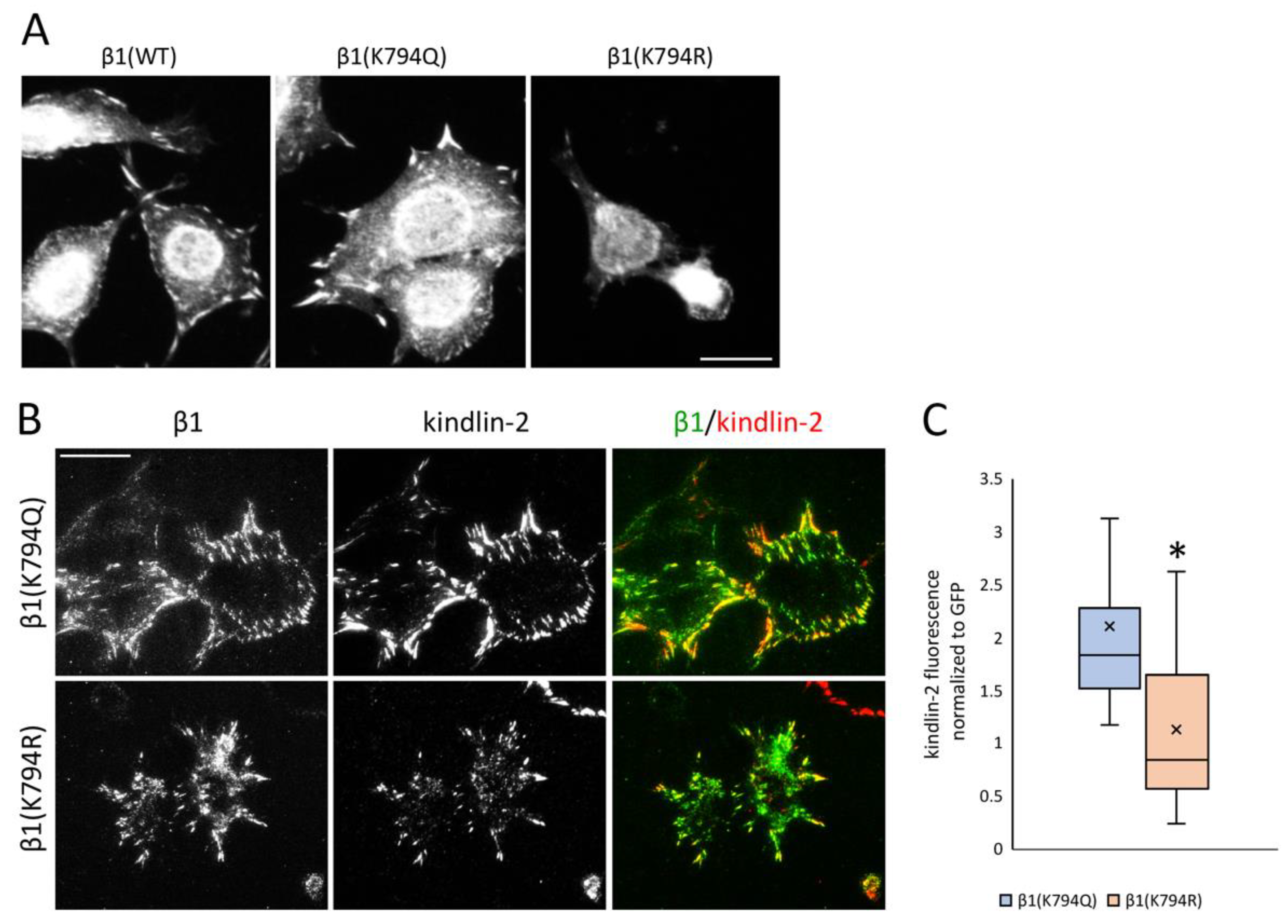 Stimulation of Fibronectin Matrix Assembly by Lysine Acetylation