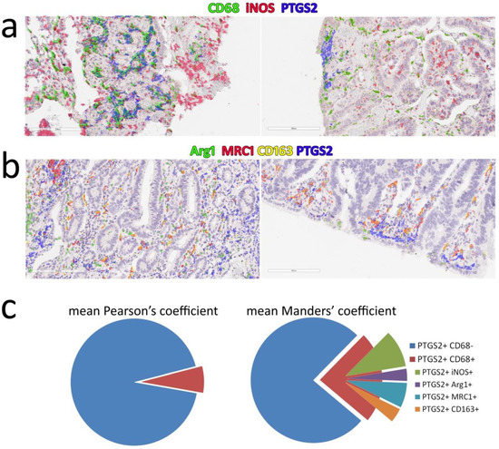 Evaluation of Glycosylated PTGS2 in Colorectal Cancer for NSAIDS-Based ...