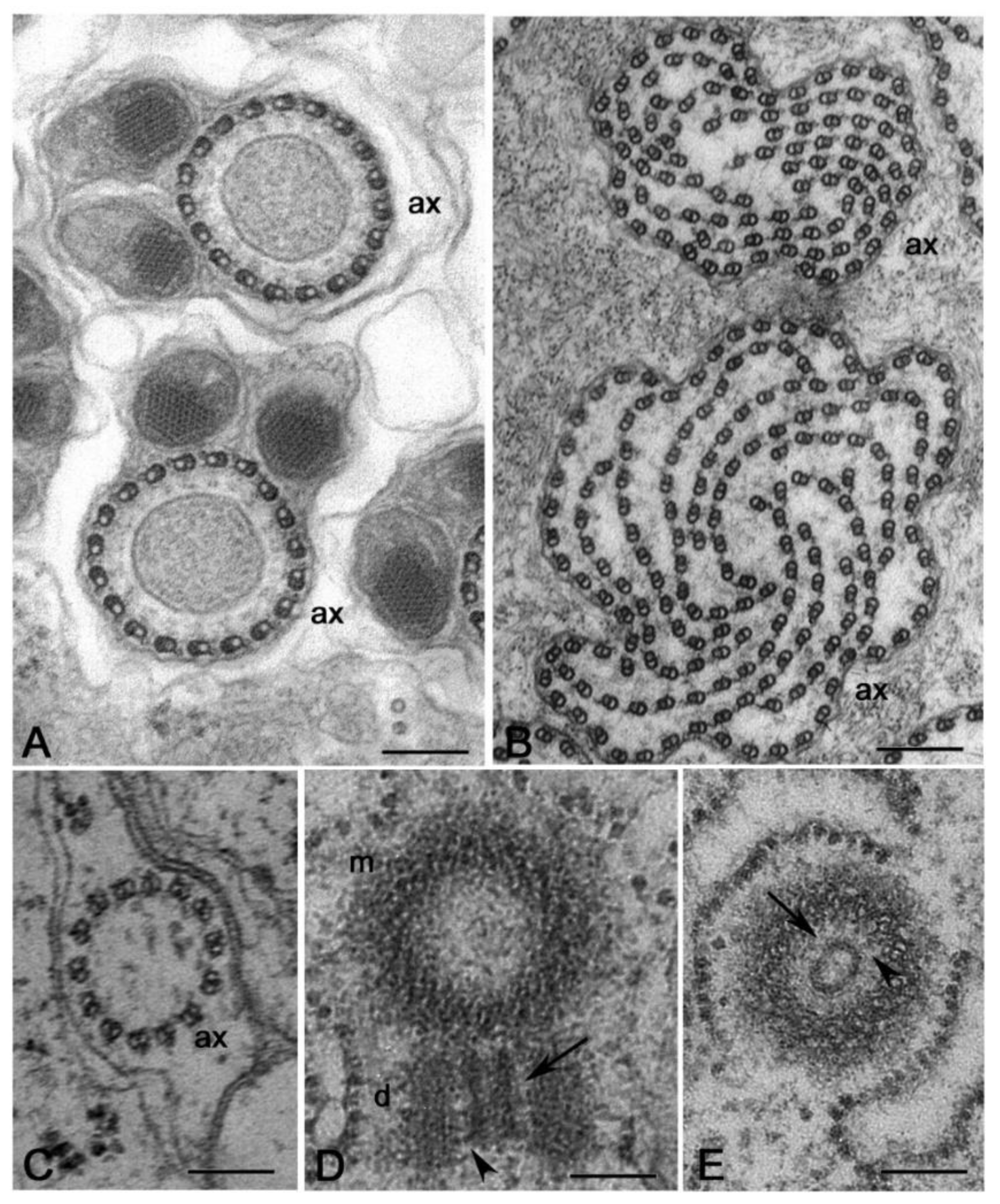 Centriole Micrograph