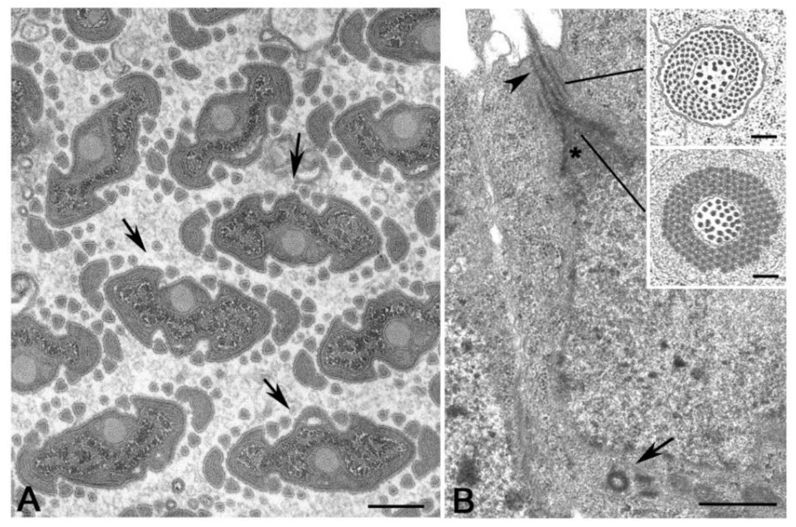Centrioles Electron Micrograph