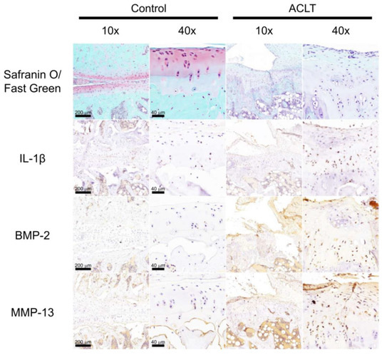 Noggin Inhibits IL-1β and BMP-2 Expression, and Attenuates Cartilage ...