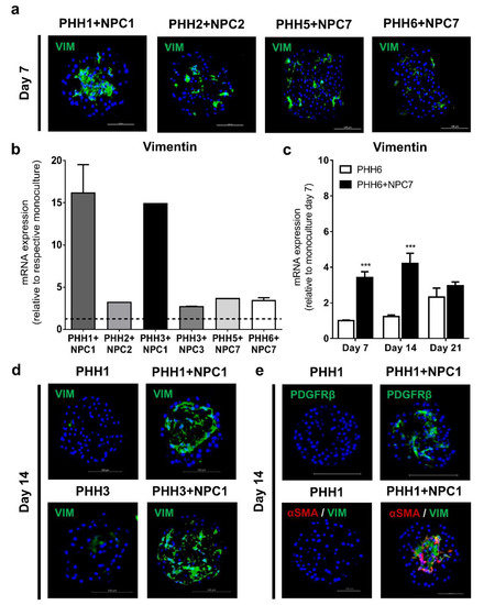 Human Liver Spheroids as a Model to Study Aetiology and Treatment of ...
