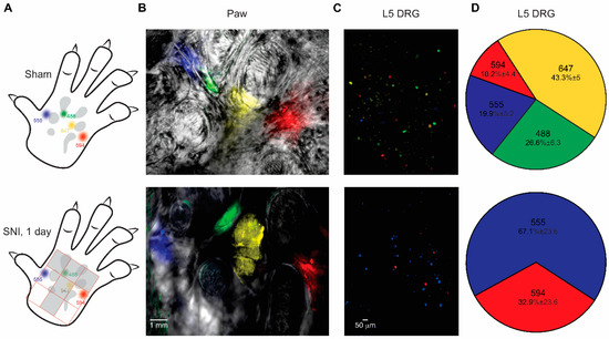 Abnormal Reinnervation of Denervated Areas Following Nerve Injury ...