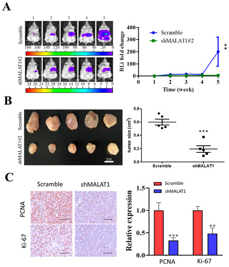 Targeting the Epigenetic Non-Coding RNA MALAT1/Wnt Signaling Axis as a ...
