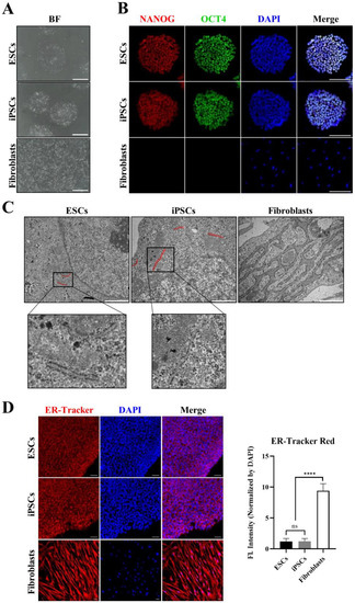 Characterization of Endoplasmic Reticulum (ER) in Human Pluripotent ...