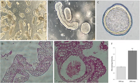 Organoids of Human Endometrium: A Powerful In Vitro Model for the ...