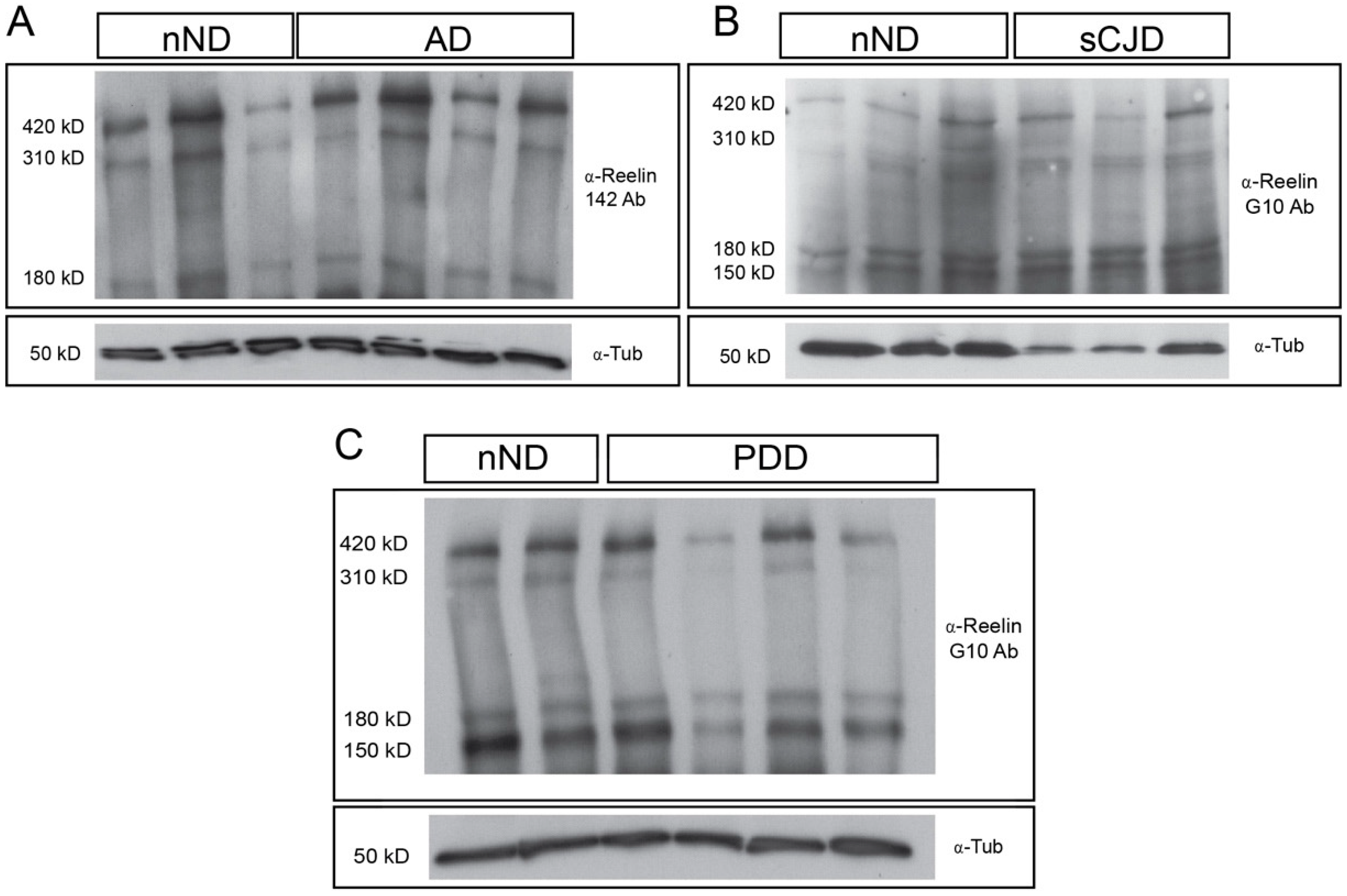 Cells | Free Full-Text | Disease-Specific Changes in Reelin Protein and ...