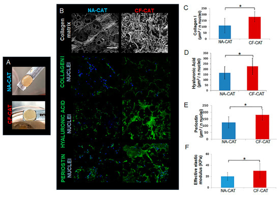 Intrinsic Abnormalities of Cystic Fibrosis Airway Connective Tissue ...