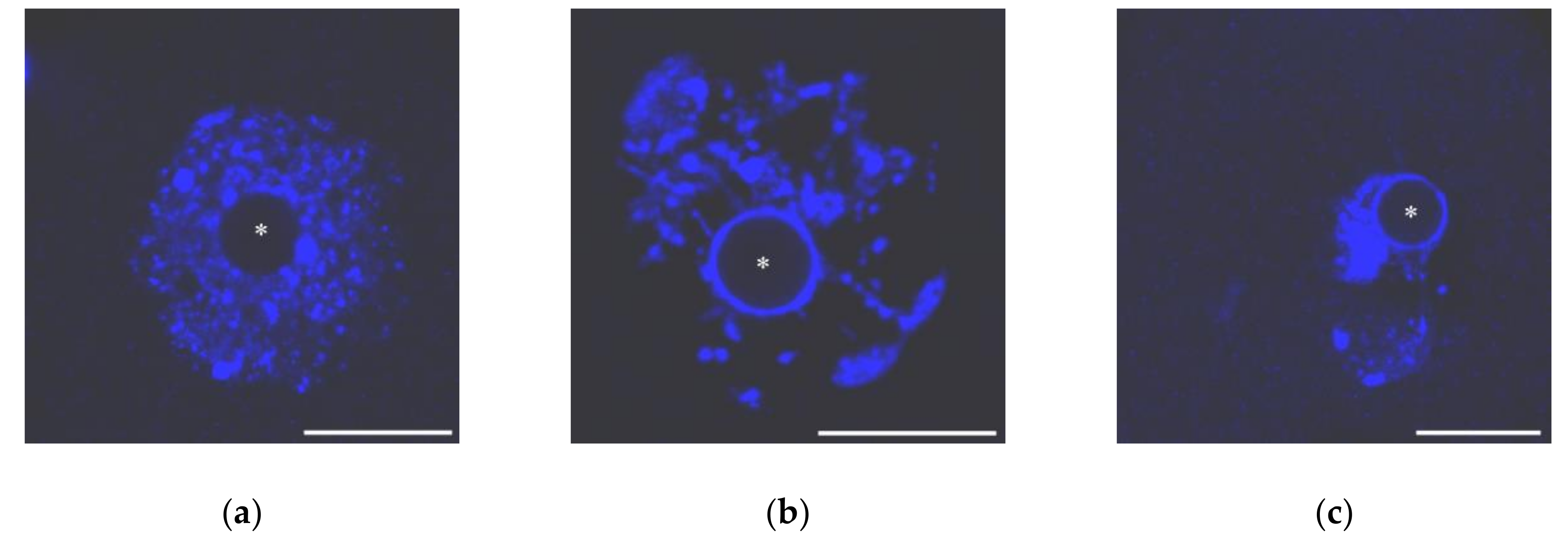 Heterochromatin Morphodynamics in Late Oogenesis and Early ...