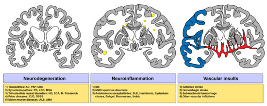 The S1P–S1PR Axis in Neurological Disorders—Insights into Current and ...