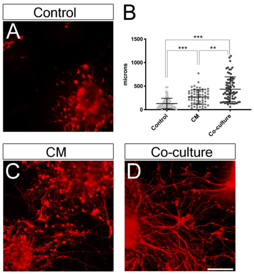 Effects of Adult Müller Cells and Their Conditioned Media on the ...
