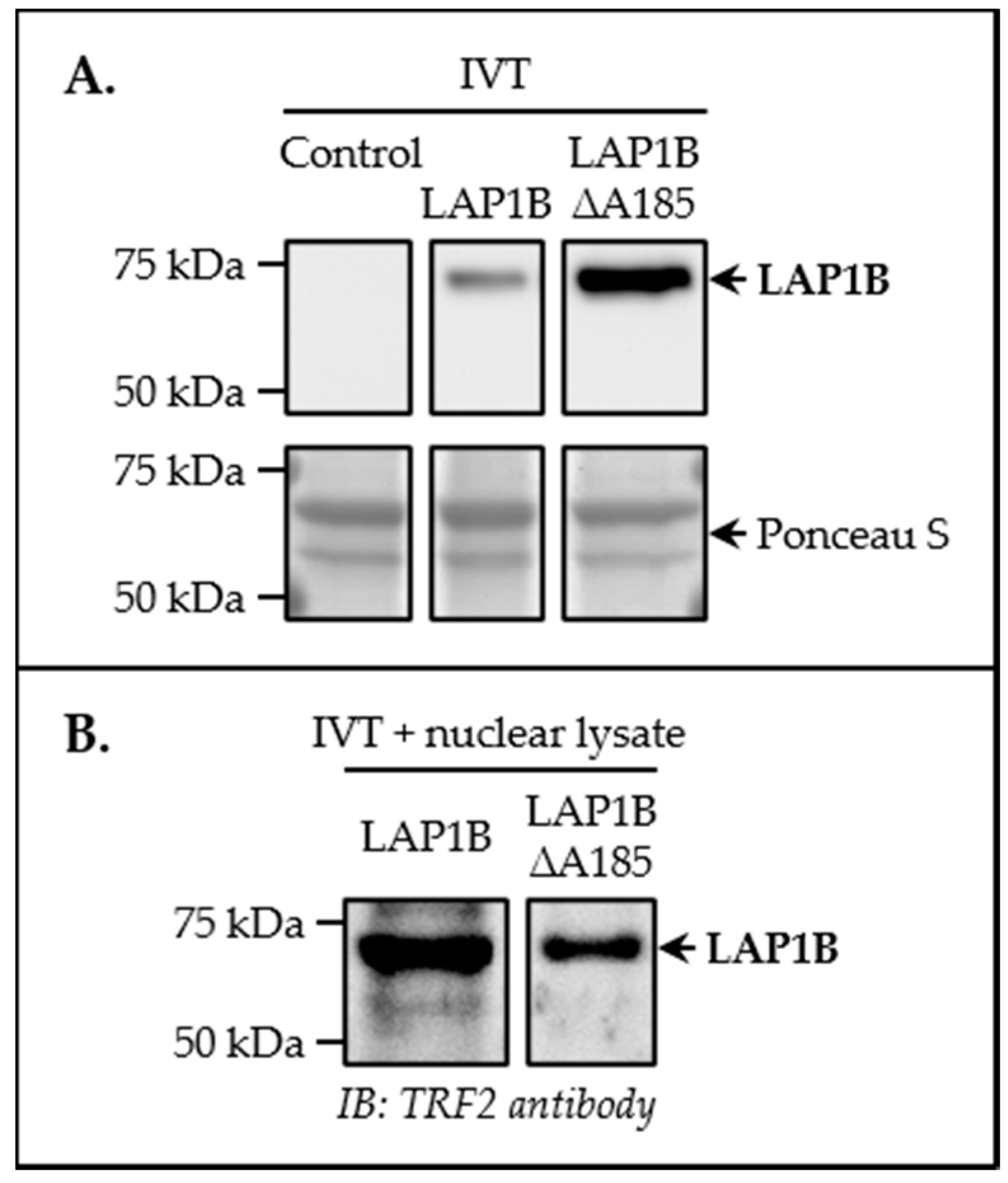 Cells | Free Full-Text | Nuclear Accumulation of LAP1:TRF2 Complex ...
