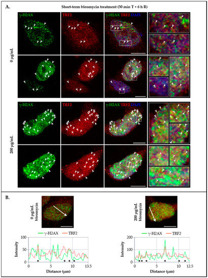 Cells | Free Full-Text | Nuclear Accumulation of LAP1:TRF2 Complex ...