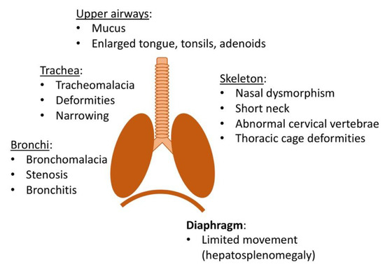 Mucopolysaccharidosis Type I: A Review of the Natural History and ...