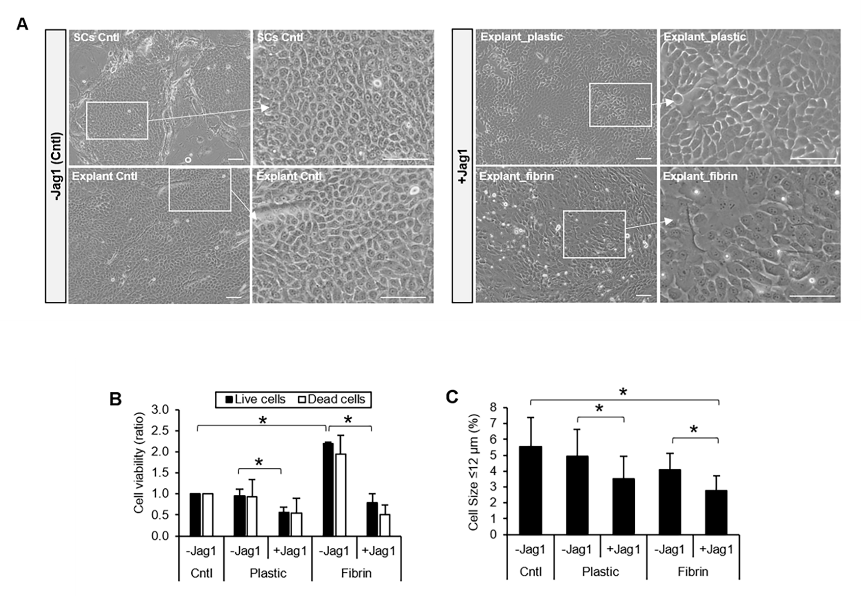 Cells | Free Full-Text | Role of Jagged1-mediated Notch Signaling ...