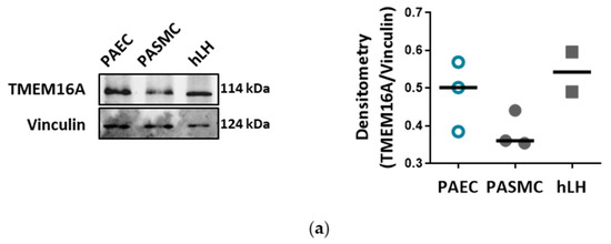 Endothelial Dysfunction Following Enhanced TMEM16A Activity in Human ...