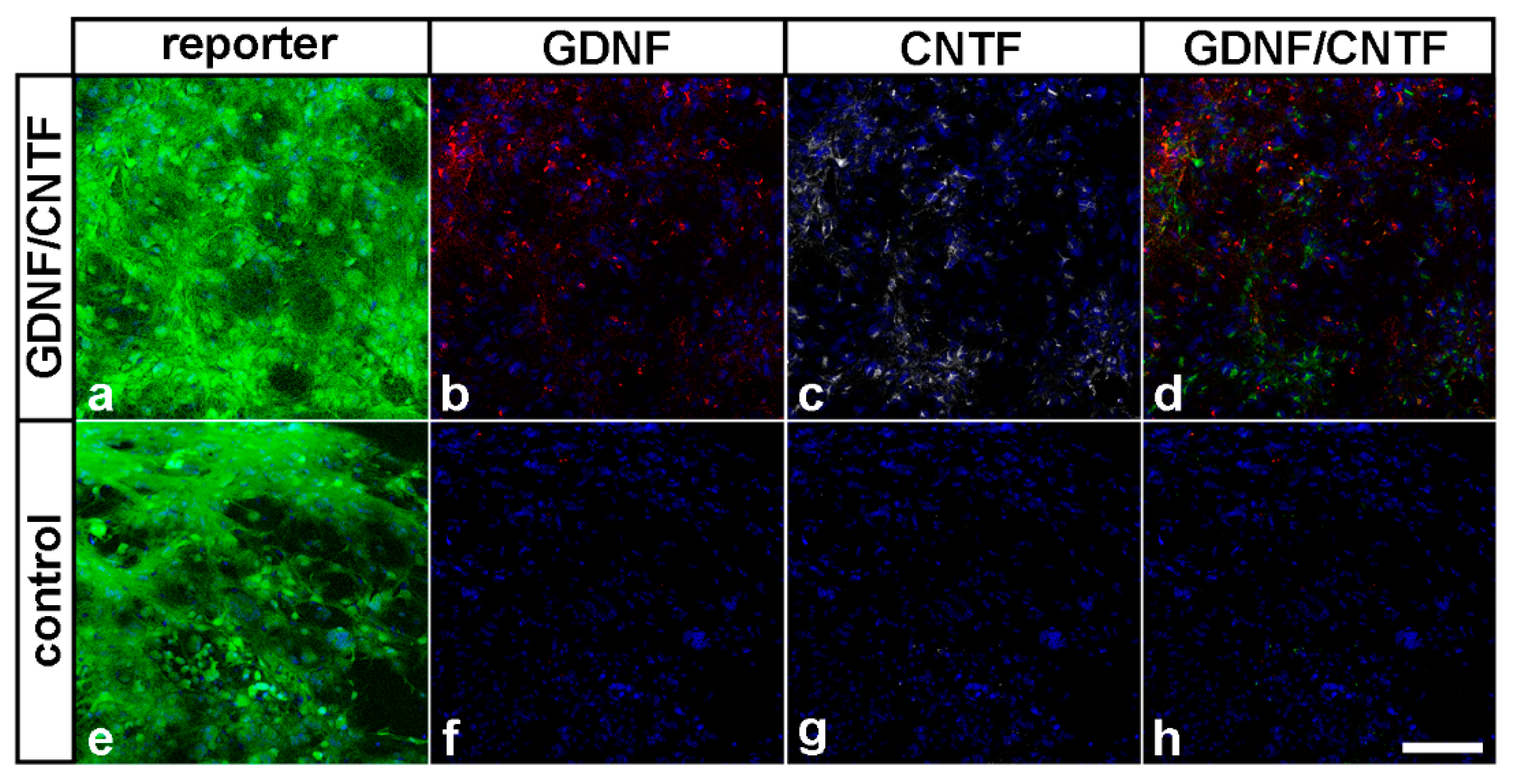 Intravitreal Co-Administration of GDNF and CNTF Confers Synergistic and ...