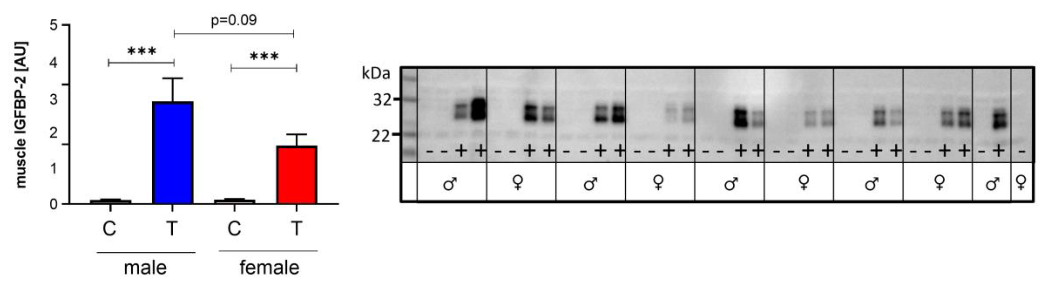 Sex-Specific Control of Muscle Mass: Elevated IGFBP Proteolysis and ...