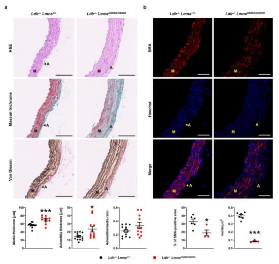 Cells | Special Issue : The New Frontier of Therapies for Nuclear ...