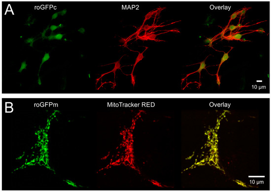 Overshooting Subcellular Redox-Responses in Rett-Mouse Hippocampus ...