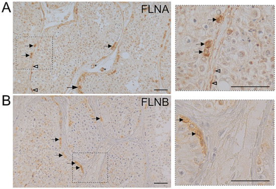 Filamin A Orchestrates Cytoskeletal Structure, Cell Migration and Stem ...