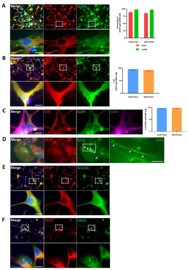Human Astrocytes Model Derived from Induced Pluripotent Stem Cells