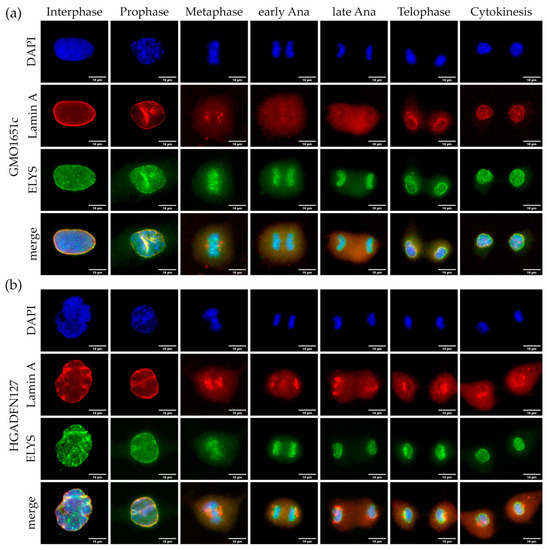 Nuclear Pore Complexes Cluster in Dysmorphic Nuclei of Normal and ...