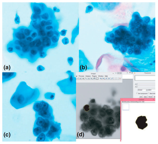 Methods for Studying Endometrial Pathology and the Potential of Atomic ...