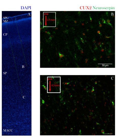 Adult Upper Cortical Layer Specific Transcription Factor CUX2 Is ...